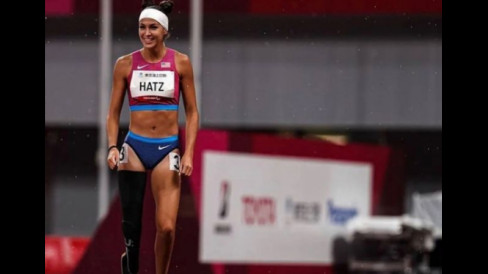 Beatriz Hatz, Si Cantik yang Menghipnotis Dunia dengan Satu Kakinya