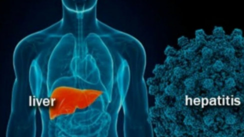 Hepatitis Akut Berbahaya, Segera Bawa Anak Anda ke Rumah Sakit Jika ...