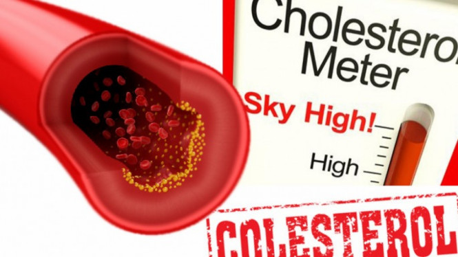Cara Mudah Cek Kolesterol Tanpa Alat Tes, Lakukan di Rumah Saja, Tak ...