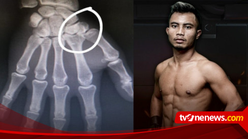 Eperaim Cedera, Haris Sopian dan Yudi Cahyadi Siap Maju ke Title Fight OnePride