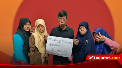 Disorot Netizen, Keluarga Manurung Mengidap Penyakit Langka ´Sindrom ...
