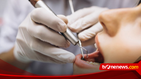 Lho, Dokter Gigi Kini 'Dilarang' Cabut Gigi tapi Diganti dengan Metode Ini