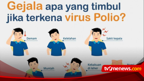 Simak! Ini Gejala Terserang Virus Polio, Mulai dari Demam hingga Nyeri ...