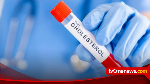 3 Obat Kolesterol Ampuh dan Harga Terjangkau yang Ada di Apotek