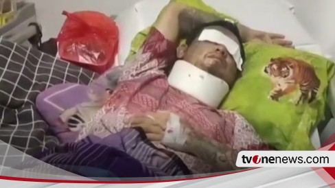 Fakta dan Kondisi Terkini Pria Korban Tragedi Congkel Mata di Bogor ...